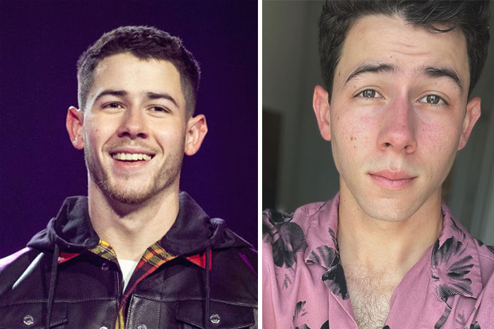 Nick Jonas Shows Off His Fresh Face