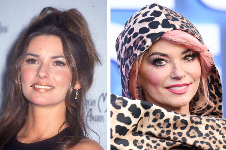 Shania Twain Opens Up About Cosmetic Surgery